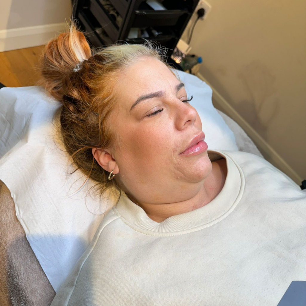 Lemon Bottle Treatments | KK Clinic Treatments